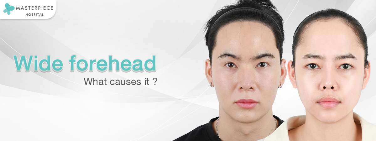 Hairline lowering reduces the forehead and fixes a wide forehead.