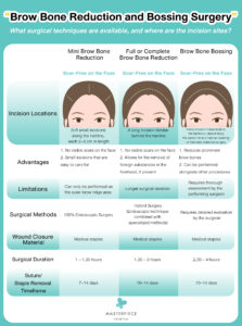 Brow Bone Reduction, Forehead Contouring, and Shaving