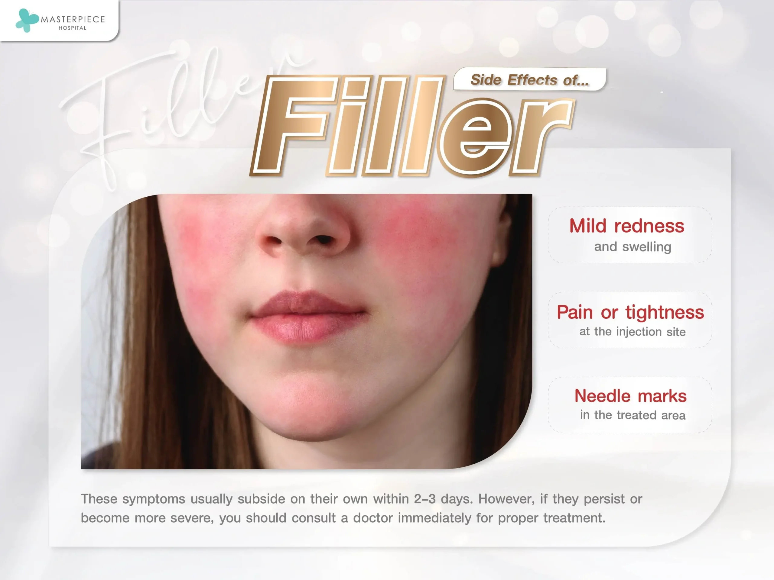 What are fillers, what can they help with, what should you know, and ...
