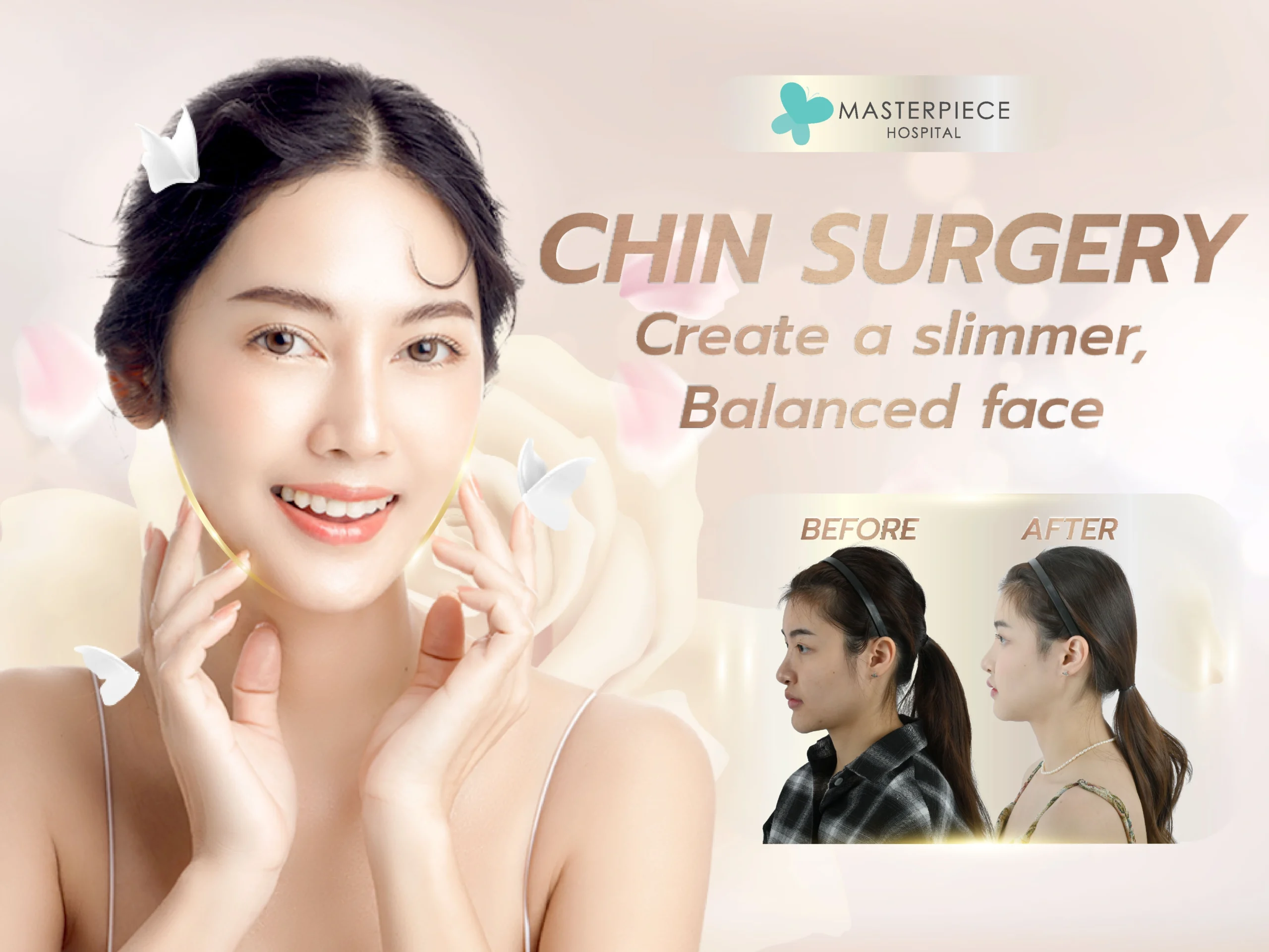 Chin Surgery: Create a Slimmer, Well-Balanced Facial Profile - Masterpiece