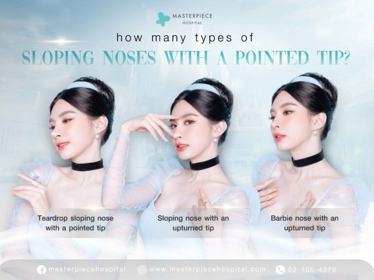 Upturned Nose Tip: Filler, Thread Lift, or Botox?