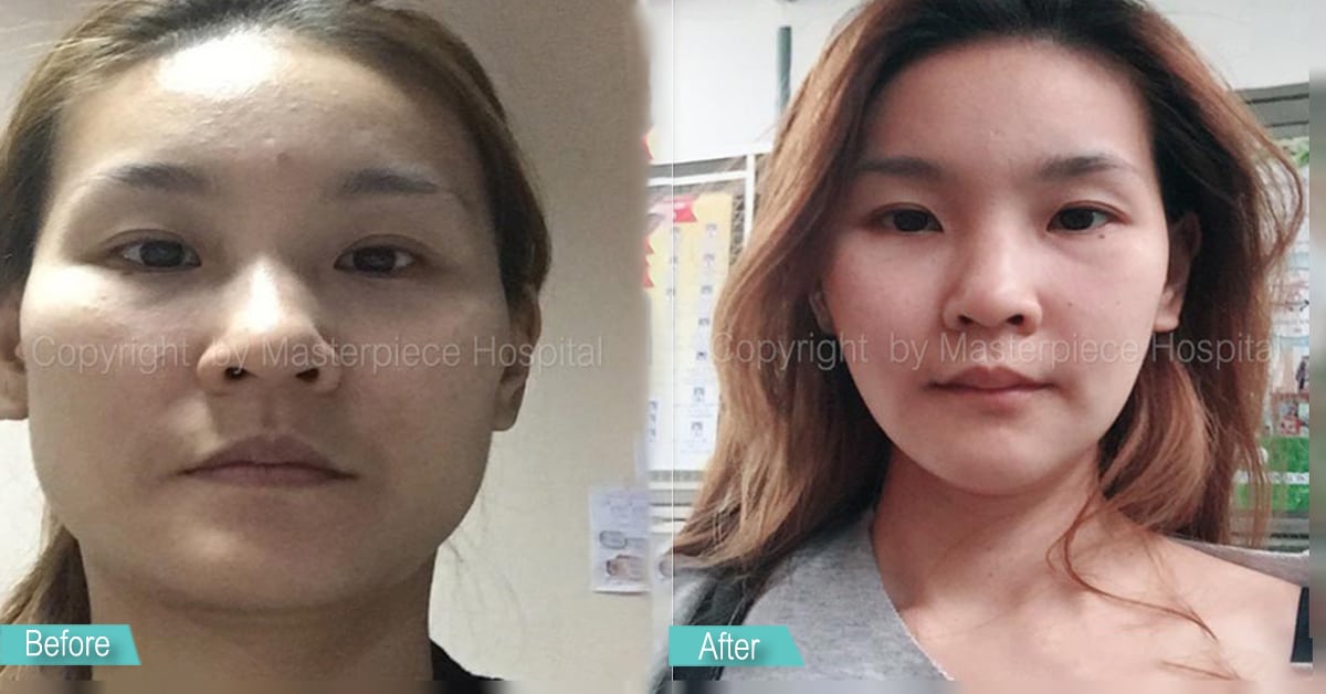 Master Review - Masterpiece Hospital