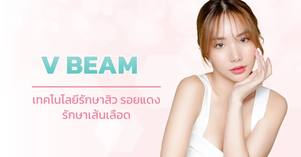 Laser V Beam เทคโนโลยีใหม่ล่าสุด สยบทุกปัญหารอยแดงกวนใจ